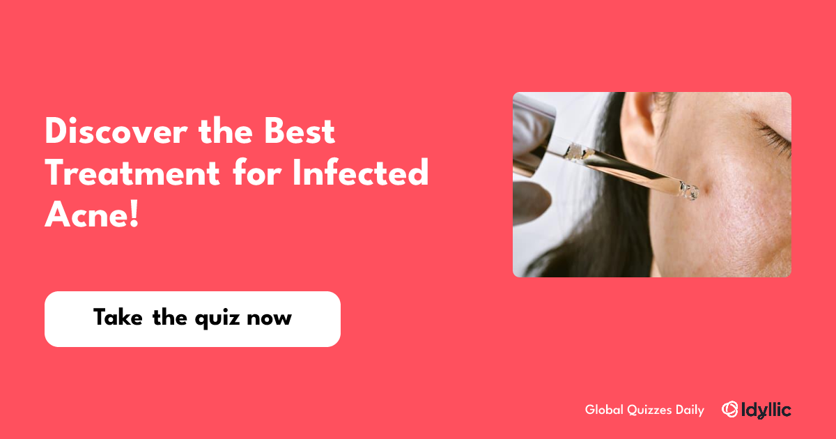 Discover the Best Treatment for Infected Acne!